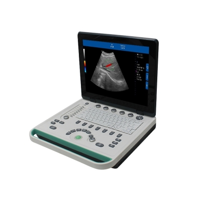 Portable Laptop Color Doppler Ultrasound Medical 3D Doppler